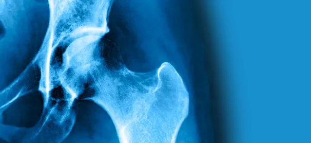 Chirurgie orthopédique | Dr. Majed ISSA chirurgien orthopédiste